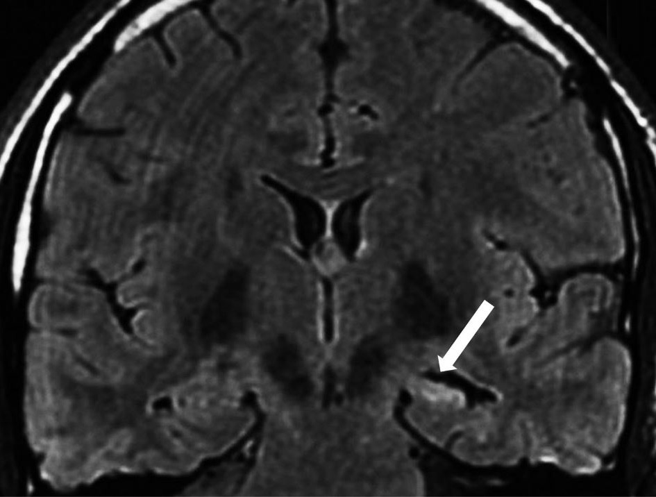 Dr Balaji Anvekar FRCR: MY PARENT INSTITUTE 3T MRI