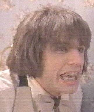 Braces Memories: Braces In The '90s and '00s