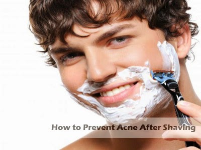 5 Tips How to Prevent Acne After Shaving | Hormonal Acne Tips