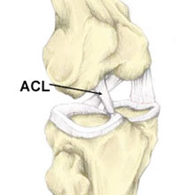 Art/Yoga Fusion: ACL vs PCL?