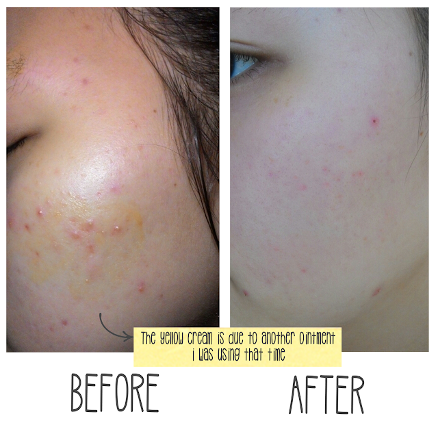 OSEUR way to a Beautiful You - Petitchini