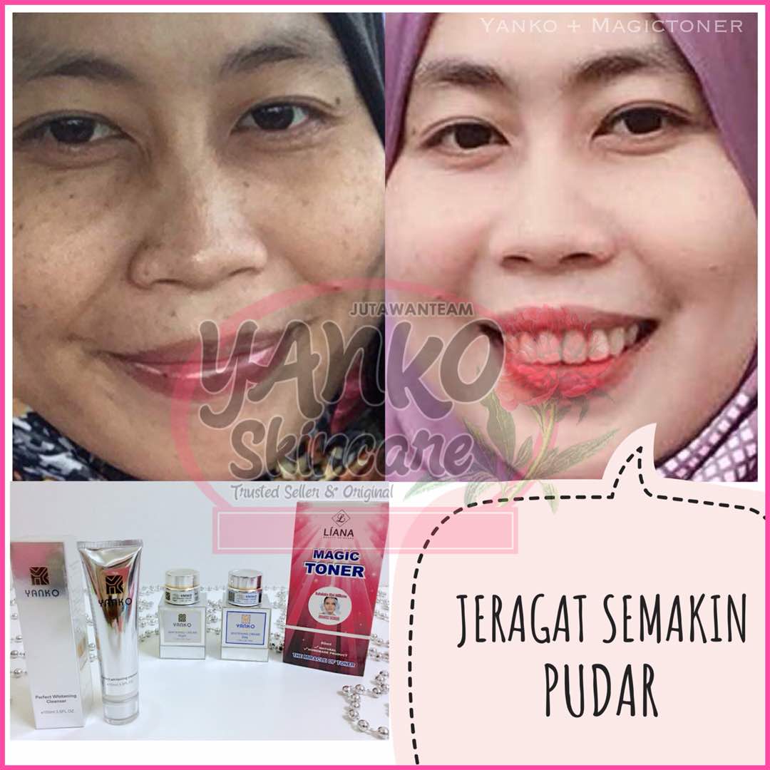 YANKO SKINCARE MALAYSIA