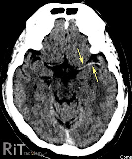 RiT radiology: March 2011