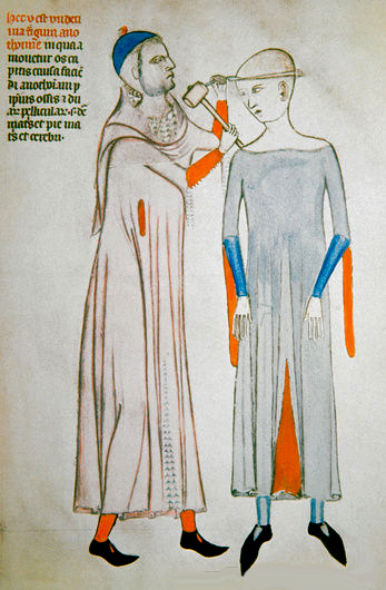 CoastConFan Blog: TREPAN, or How I Learned to Stop Worrying and Love ...