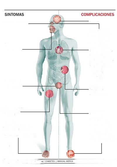 Huntington México Blog: Los síntomas de la Enfermedad de Huntington