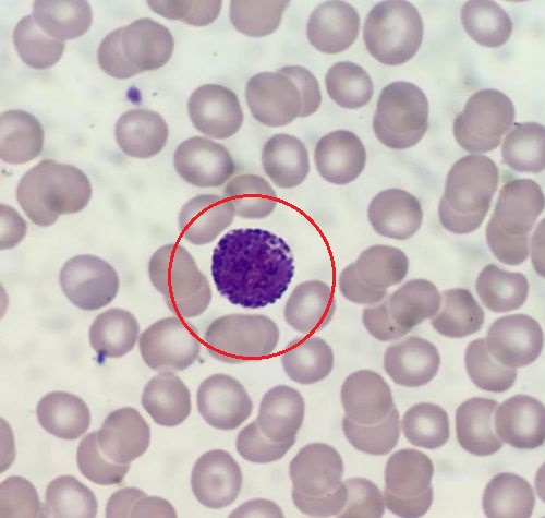 Hematologia Clínica : Atlas de Hematologia