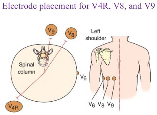 Medsign: Dasar-dasar EKG: Bagian 1