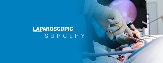Laparoscopic Surgery Is The Best Solution For Prostate Cancer ...