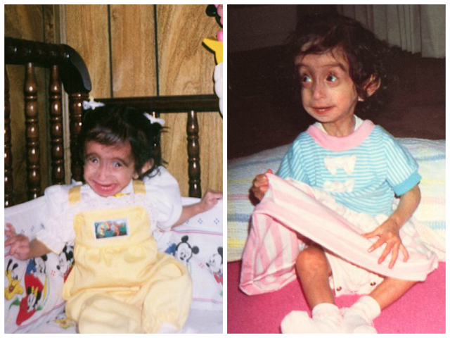 Kamify Blog: Meet The thinnest Girl In The World: Woman, 24, Weighs 4st ...