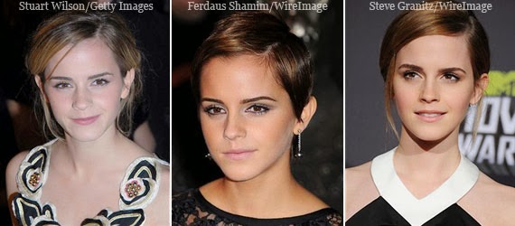 Emma Watson Plastic Surgery Nose Job Before and After Photos (Star ...