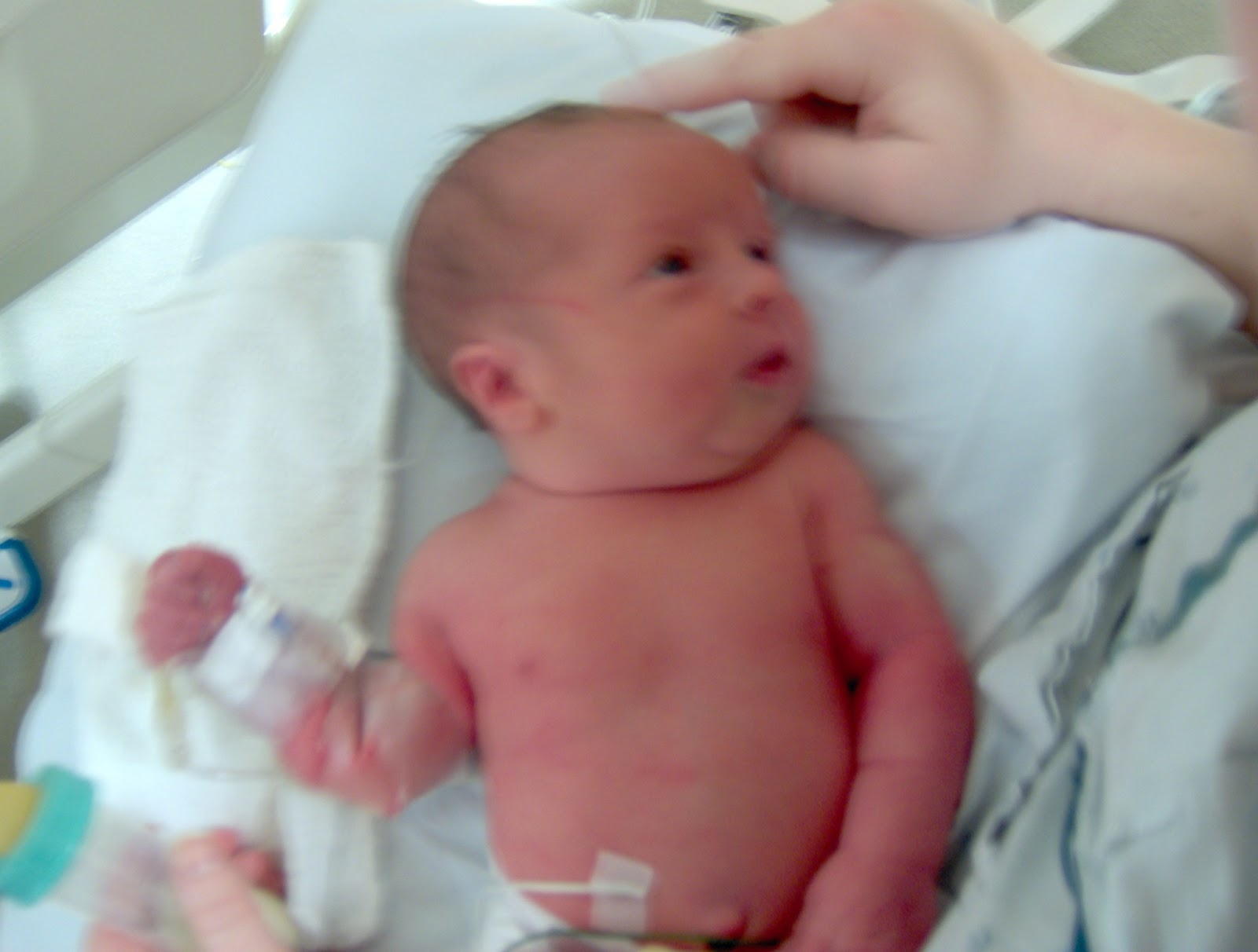 April's Country Life: My NICU Baby - Severe Chest Compression