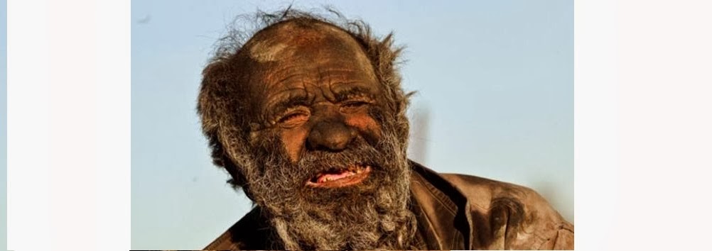 b-world Group: World's Dirtiest Man: Man Who Hasn't Had His Bath for ...
