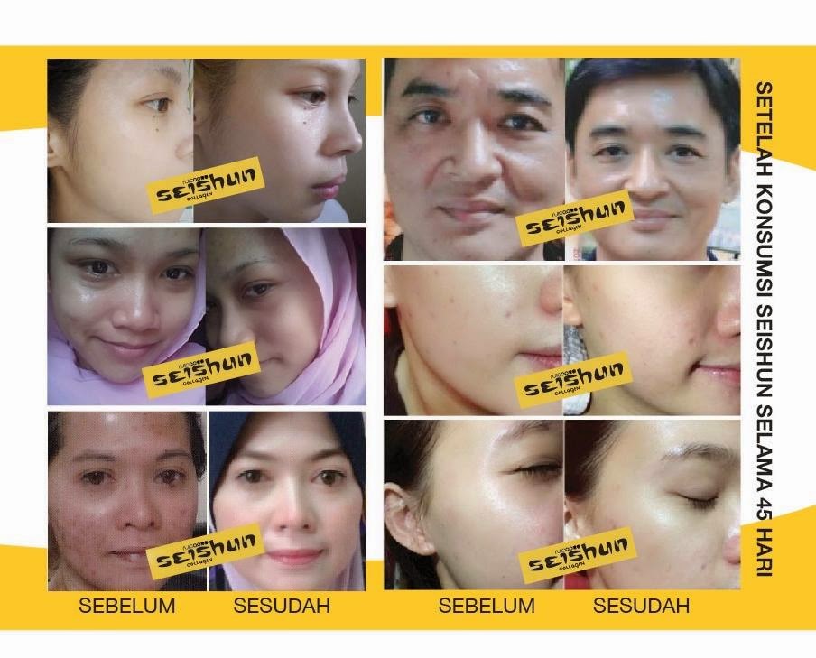 Kolagen + L.Glutathione: KOHJIN Life Sciences