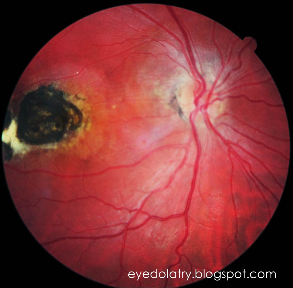 IMAGES - Eyedolatry