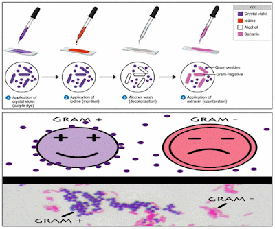 BLOGAddict: METODE PEWARNAAN GRAM (Gram Staining Method)