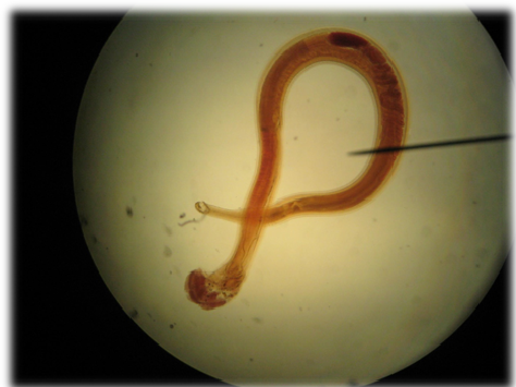 Parasitologia Tercer Semestre: Metodo de diagnostico de uncinariasis