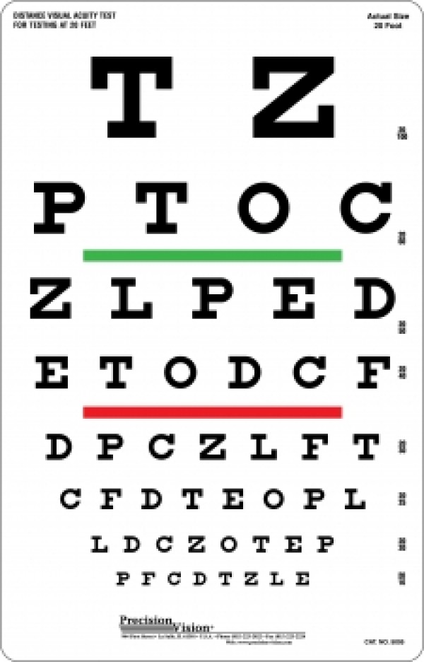 Ojo ojo