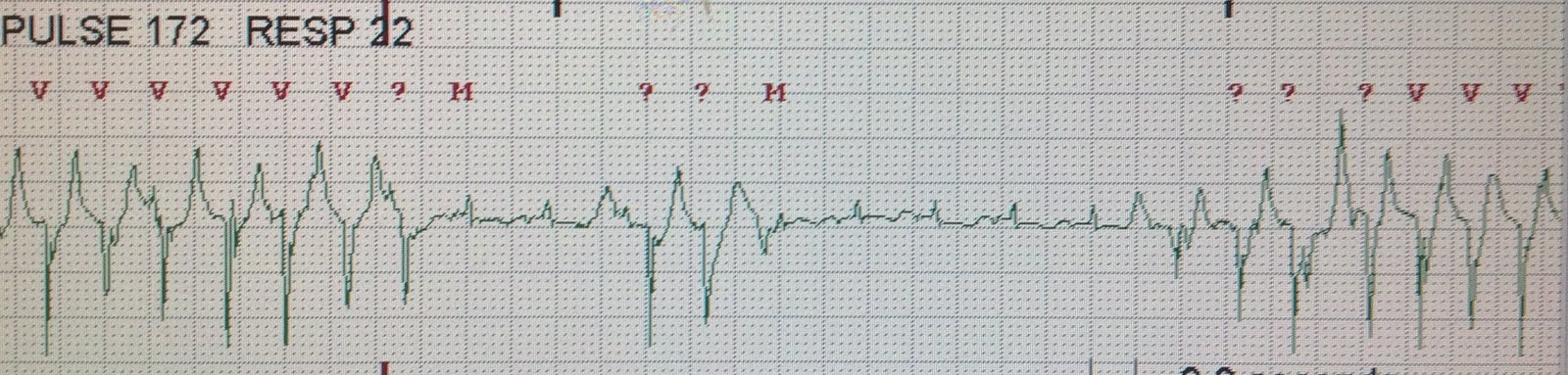 Pedi cardiology: October 2011