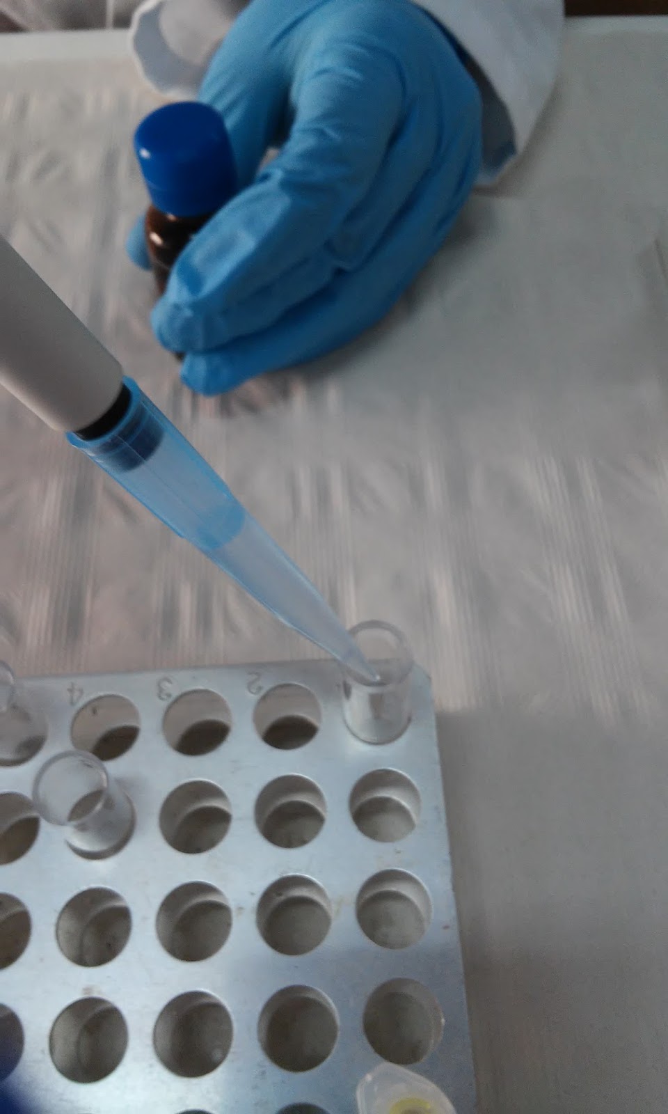 LABORATORIO DE DIAGNÓSTICO CLÍNICO: GOT ( AST) NADH, Cinético UV. IFCC rec.