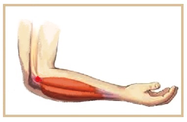 Μυοσκελετικά και άλλα θέματα: ΕΠΙΚΟΝΔΥΛΙΤΙΔΑ (lateral epicondylitis)