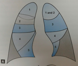 images for x ray: Bronchopulmonary Segment
