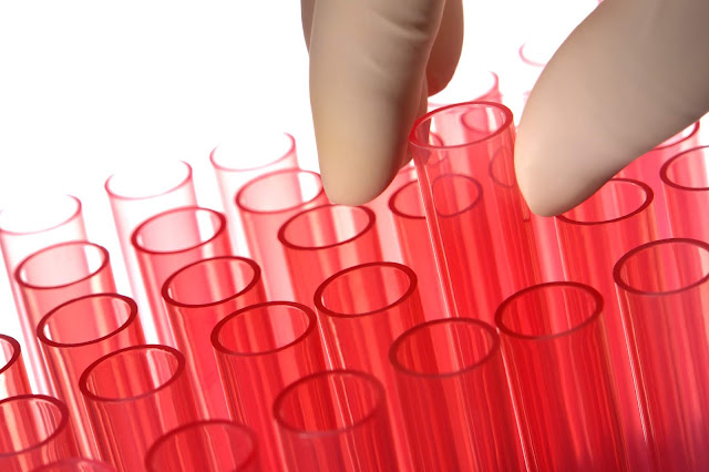 Acrylic Plastic: Uses, Properties, and Benefits