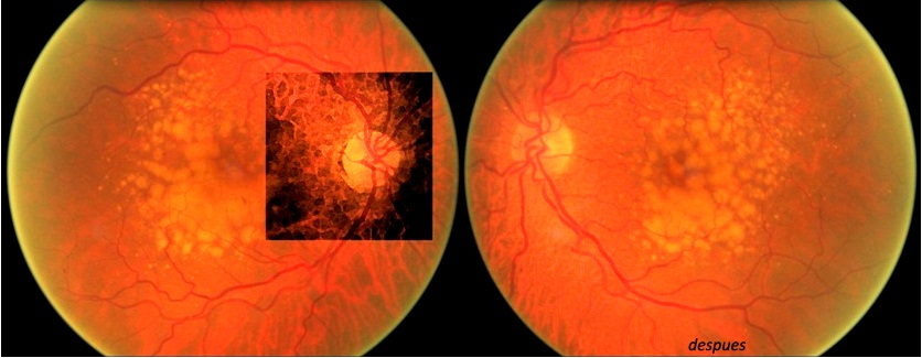 Manejo Ortóptico de las heteroforias: Manejo Ortóptico de las Heteroforias.