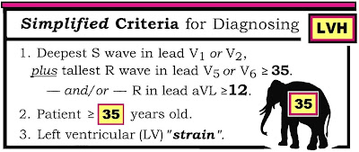 ECG Interpretation: ECG Interpretation Review #73 (LVH – Hypertrophy ...