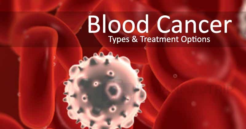 Blood Cancer Types and Treatment Options ~ Healthcare In India