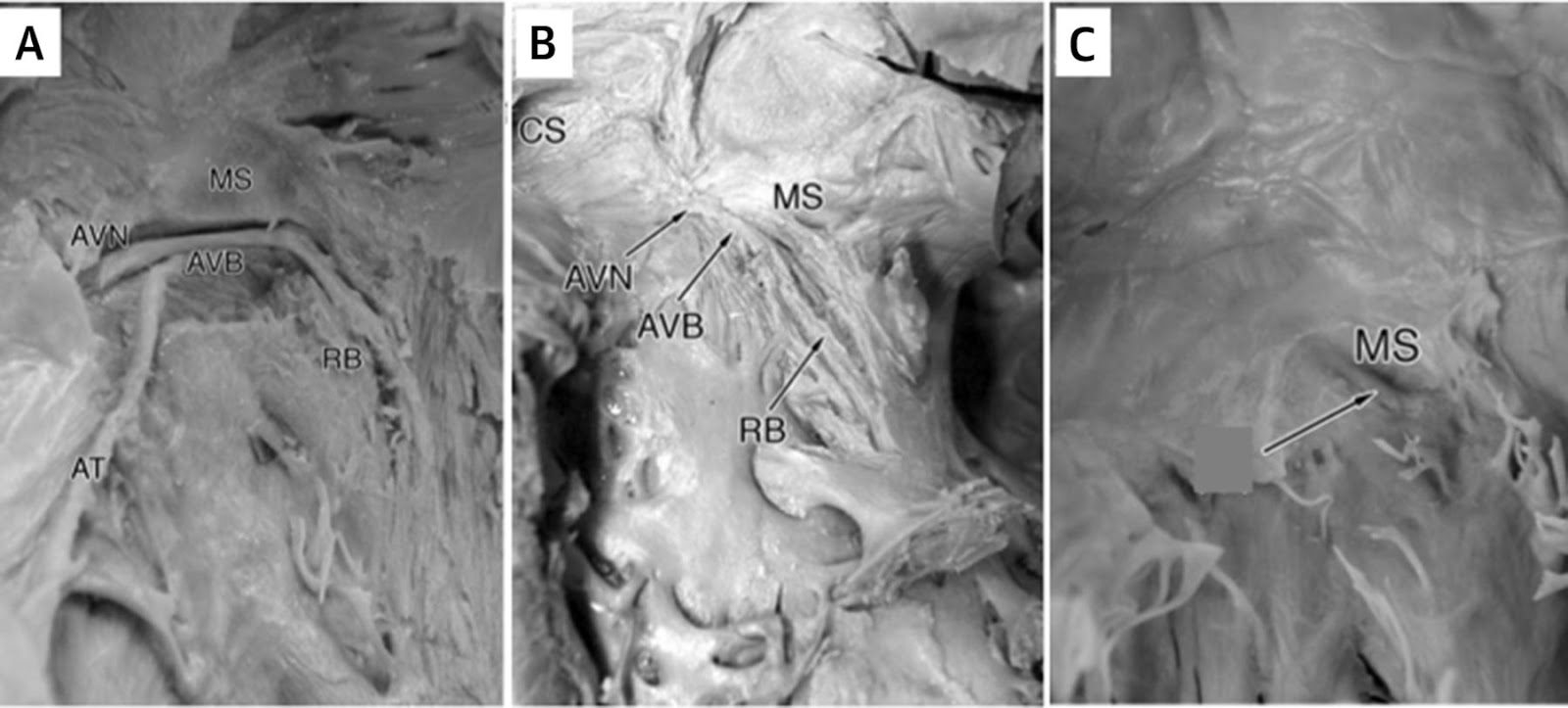 Dr Han Naung @ Henry Han : Electrophysiology and Heart Rhythm : His ...