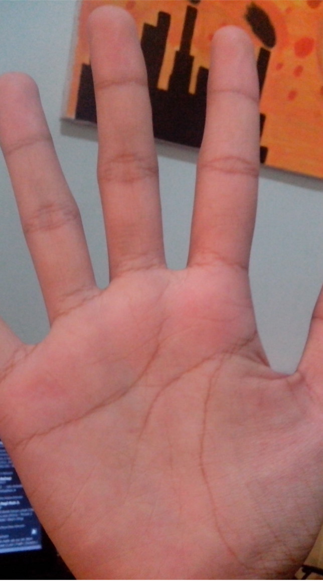 ruas jari | Yeahngaco