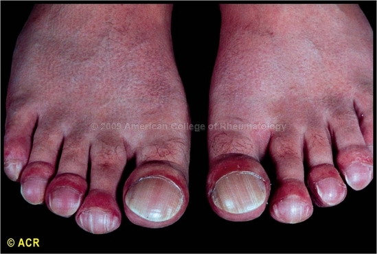 Pathology Cases: Block 2 Case 15