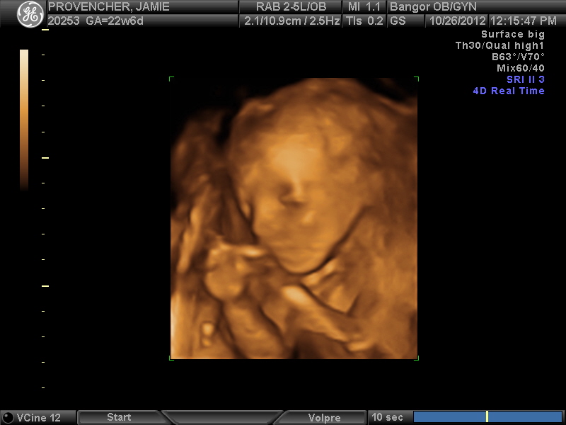 The Mommy Chronicles: 22 Weeks - Anatomy Scan #2 & Bump pics!