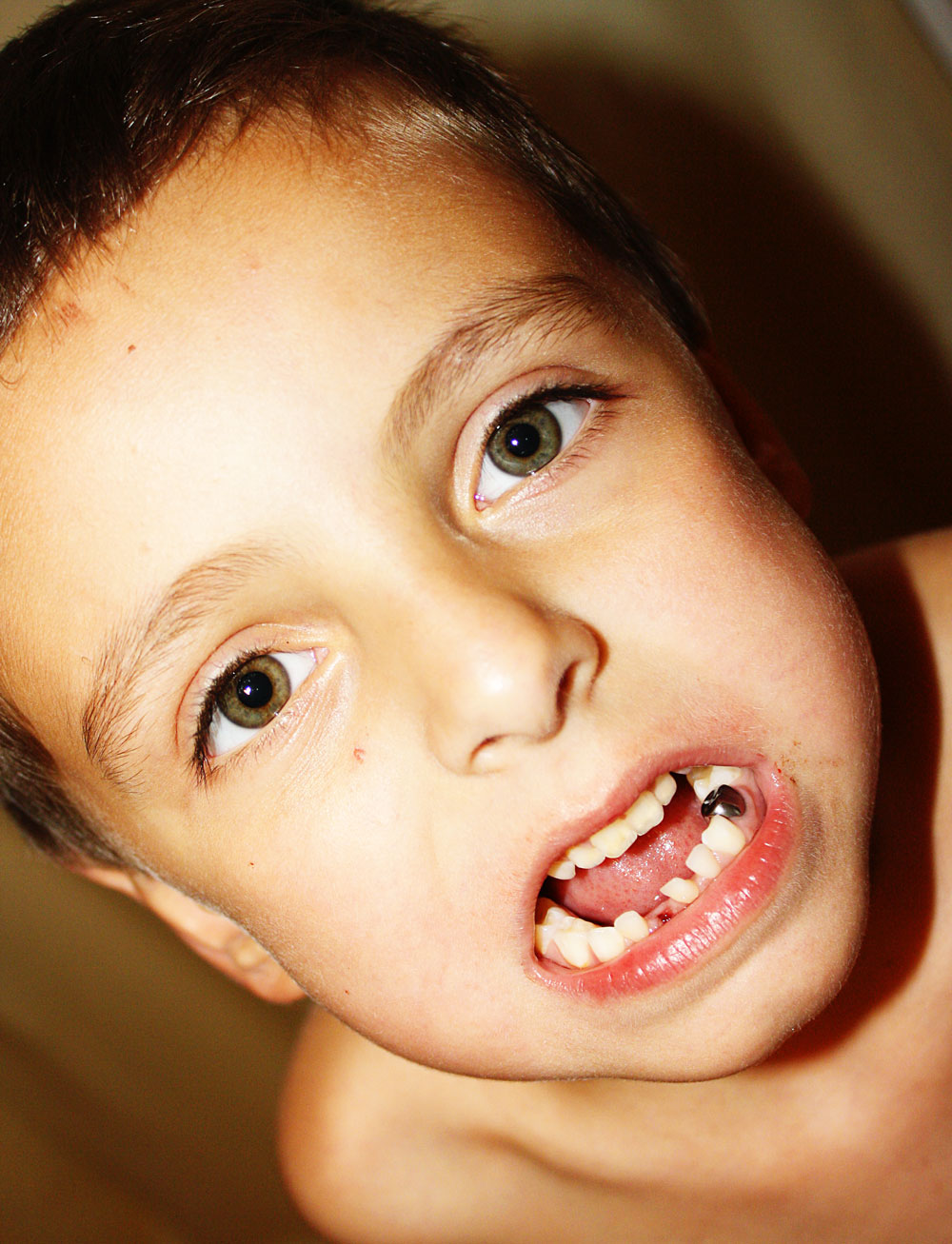 the trochelmans: One Tooth Less