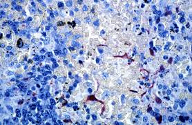 Immunostaining: Know everything about the Immunohistochemistry ...