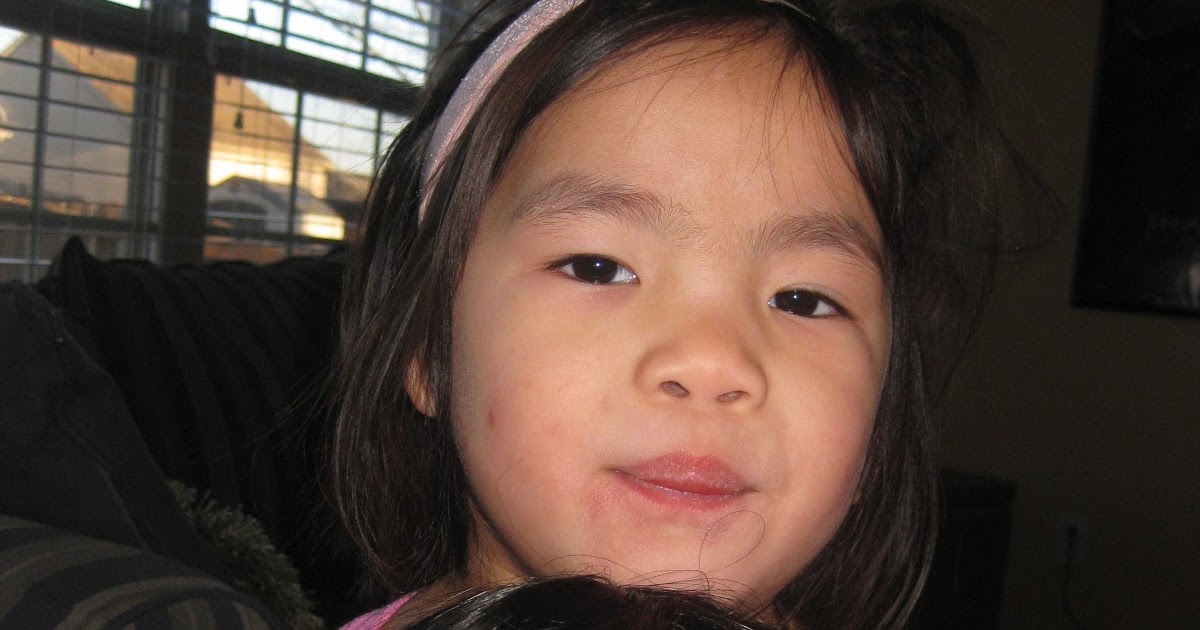 my crazy, blessed life: BAHA for baby