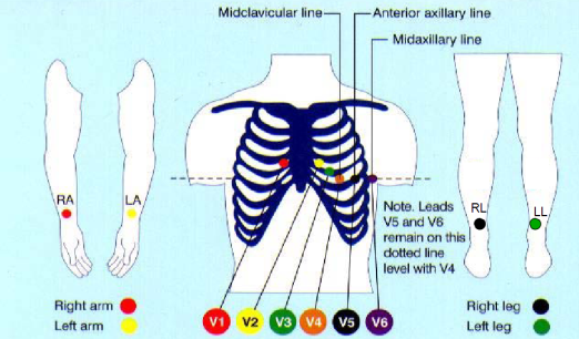 12 Lead Ecg Placement Coloring Picture For Kids Hd Images And Images