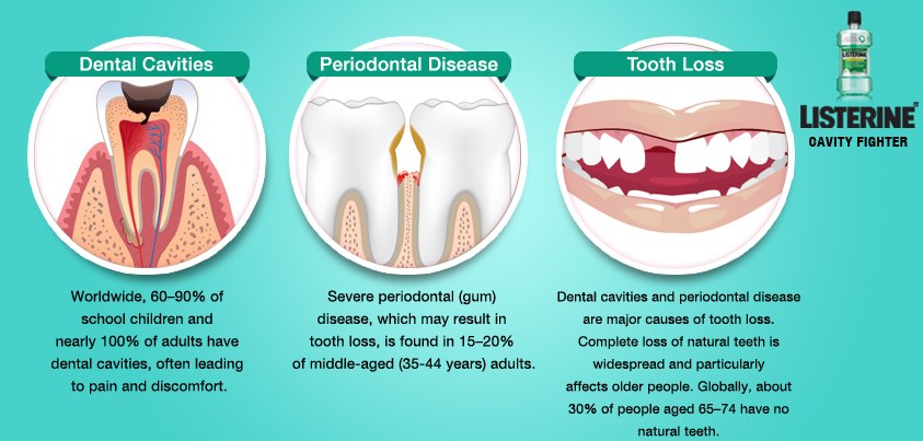 Oral Hygiene & Dental Care: A hurting tooth could be an abscess