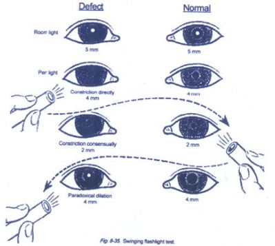 Pembahasan Soal UN Biologi SMA Paket 1 Soal No 16 Tahun Pelajaran 2016/2017