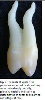 Endodontic: MAXILLARY FIRST PREMOLAR