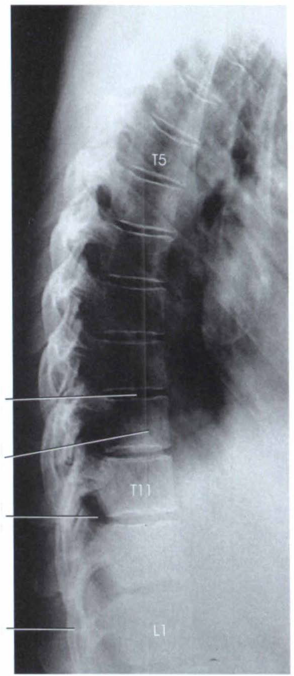 TEKNIK RADIOGRAFI THORAKAL - Radiografer