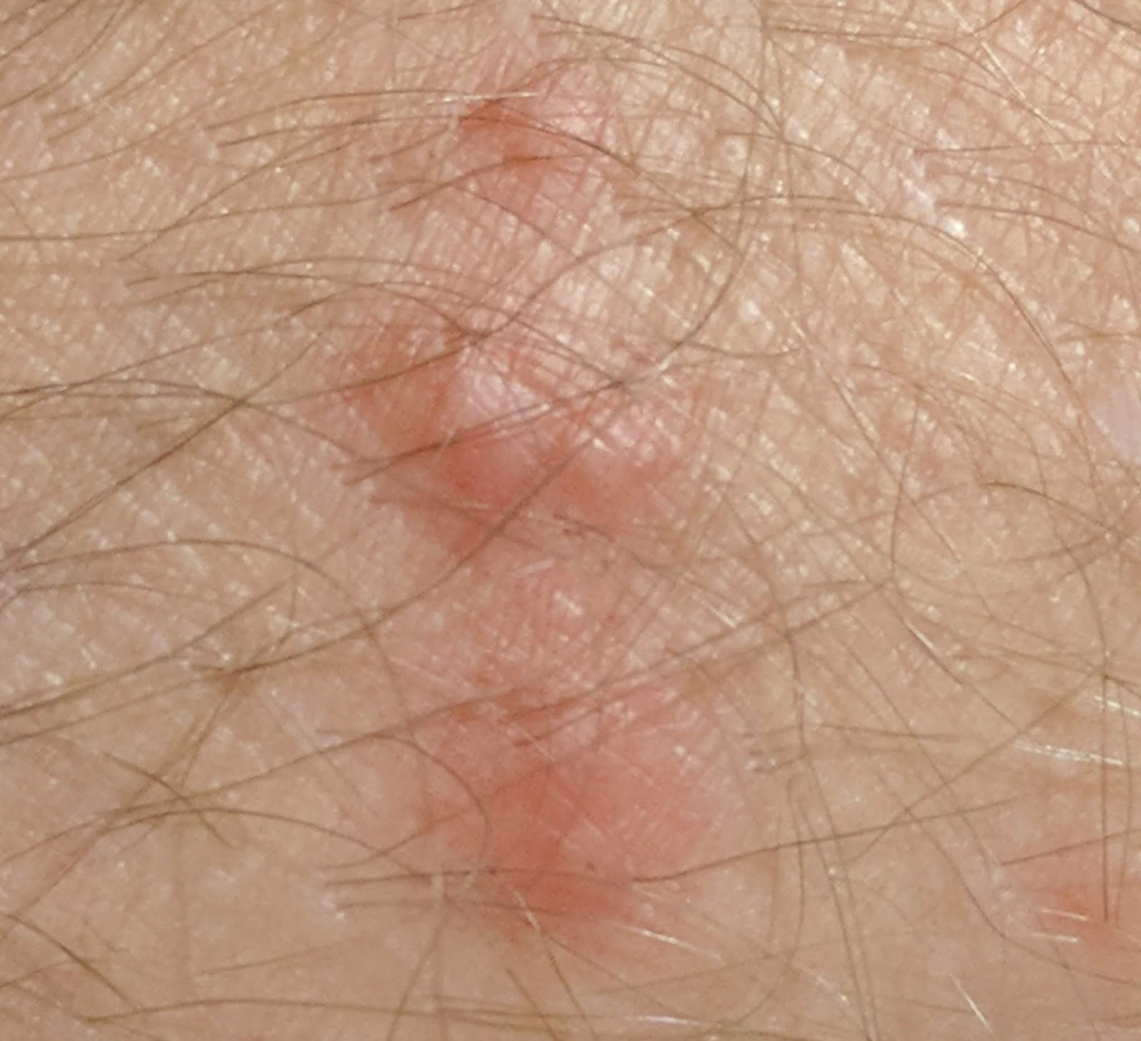 Uidumõtteid ja juhtumisi: Huatulco Needus 5 - Parasiidid, putukad ...