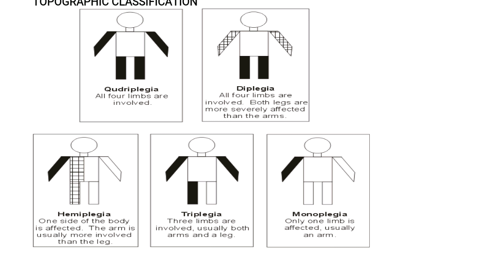 cerebral palsy definition | cerebral palsy types - PHYSIO STUDY