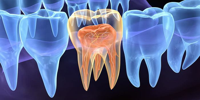 What causes you to need a root canal? : Signs and Symptoms - OdontoVida