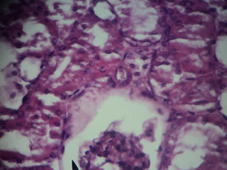 MEDICINA USMP: FOTOS DE HISTOLOGIA II - CÁPSULA DE BOWMAN