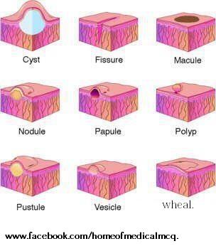 Angry Angry Guru: Different Types Of Skin Disorder