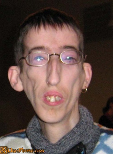 Imagens Dos Homens Mais Feios Do Mundo