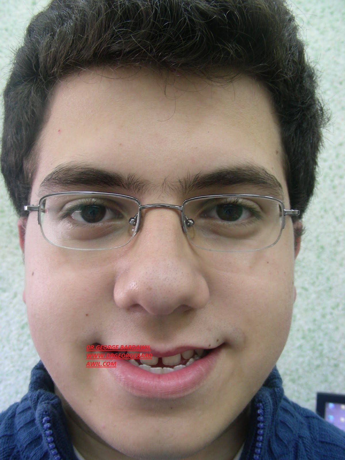 Dr.George E. Bardawil-Orthodontist-Invisalign Diamond level : Non ...