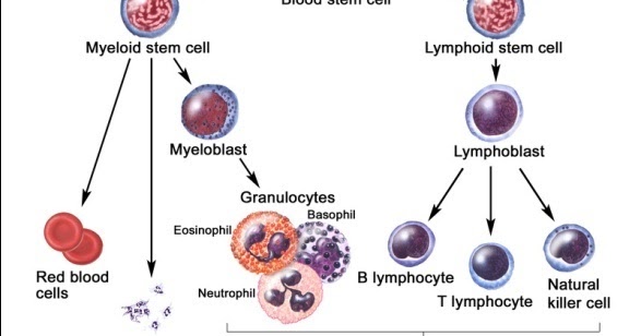 Leukemia Limfoblastik Akut (ALL) ~ Informasi Kedokteran Dan Kesehatan