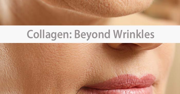 Collagen Deficiency and Wrinkles